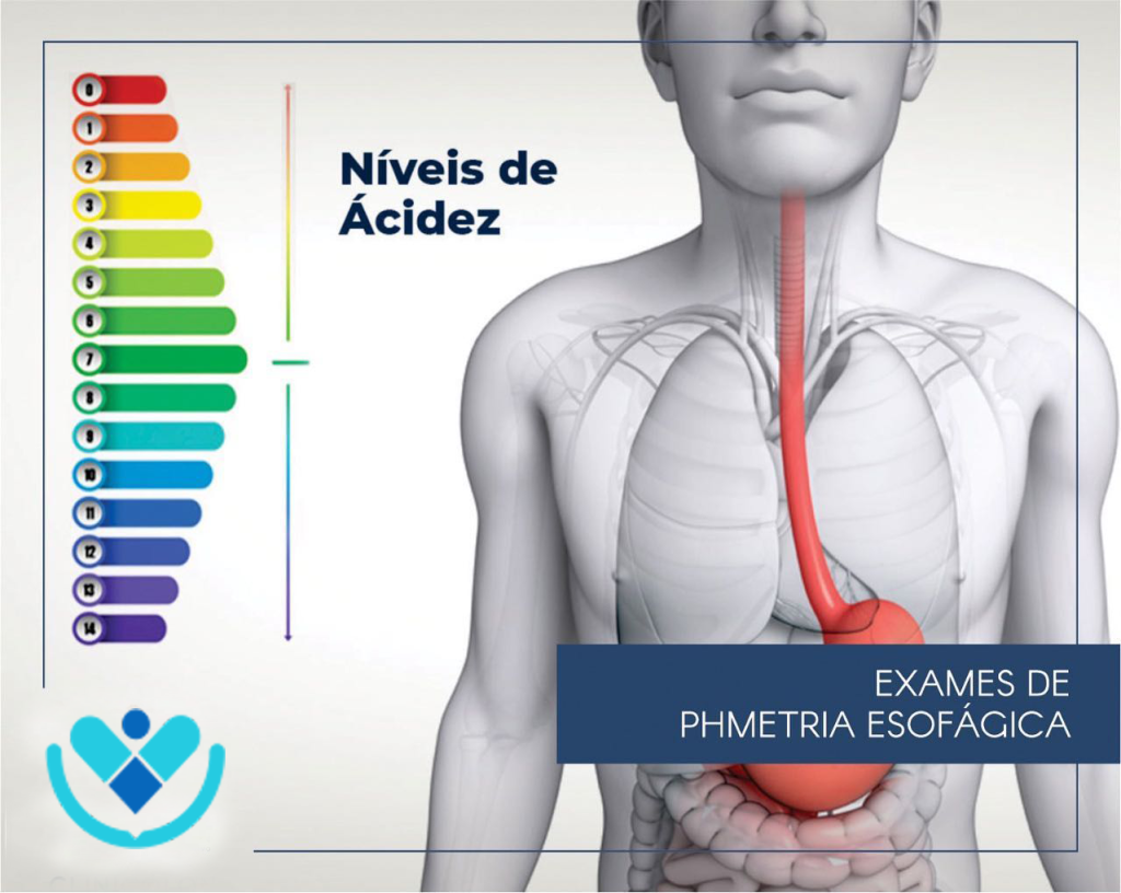 Qual a finalidade do exame pHmetria? – Instituto de Saúde Assistida