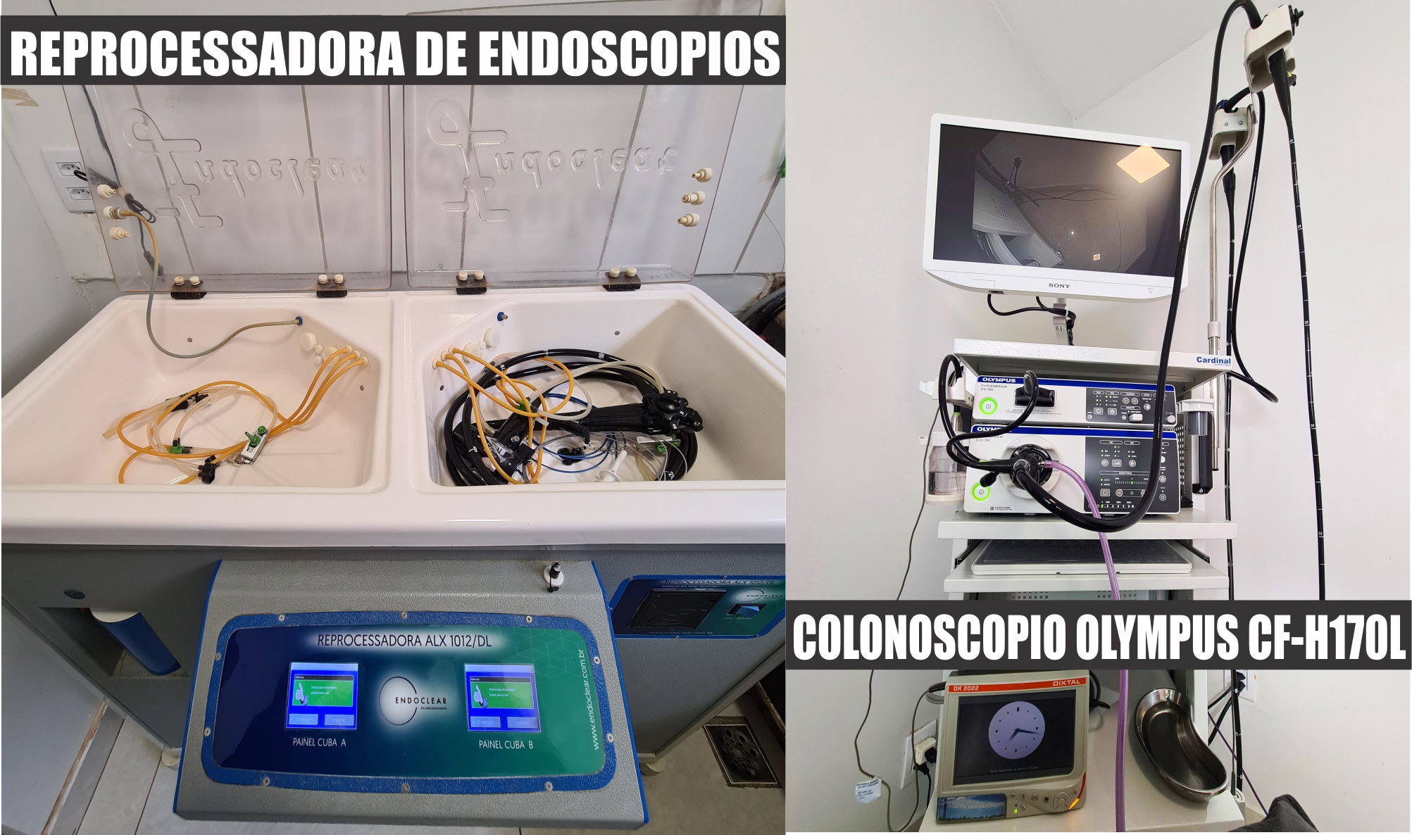 Exame de colonoscopia, porque os médicos Confiam e Indicam o ISA ...